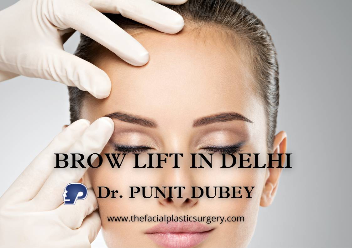 Expert Brow Lift Surgery In Delhi | Say Goodbye To Sagging Brows