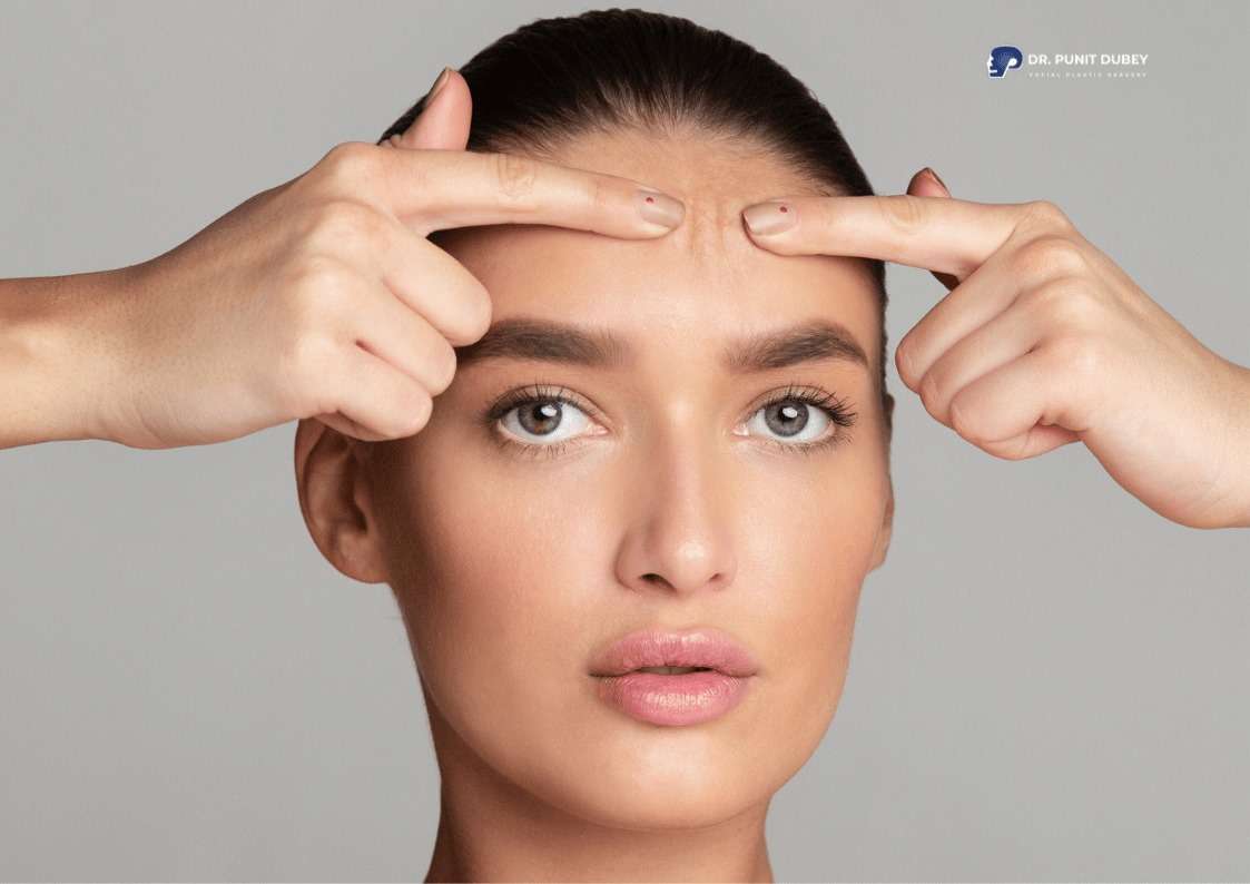Osteoma Forehead Treatment In Delhi By Dr. Punit Dubey