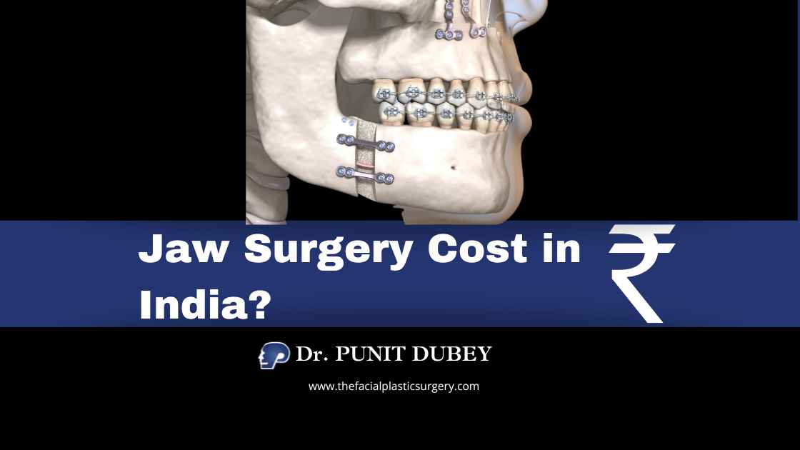 Jaw Surgery Cost In India 2026 – Transform Your Face, Jawline & Confidence