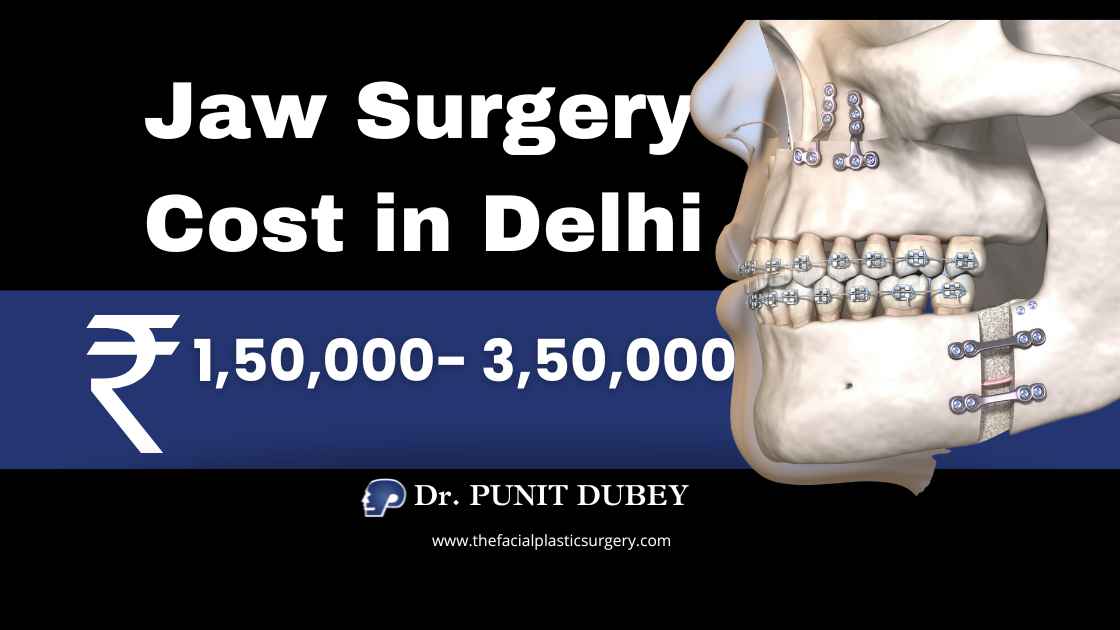 Jaw Surgery Cost In India 2026 – Transform Your Face, Jawline & Confidence